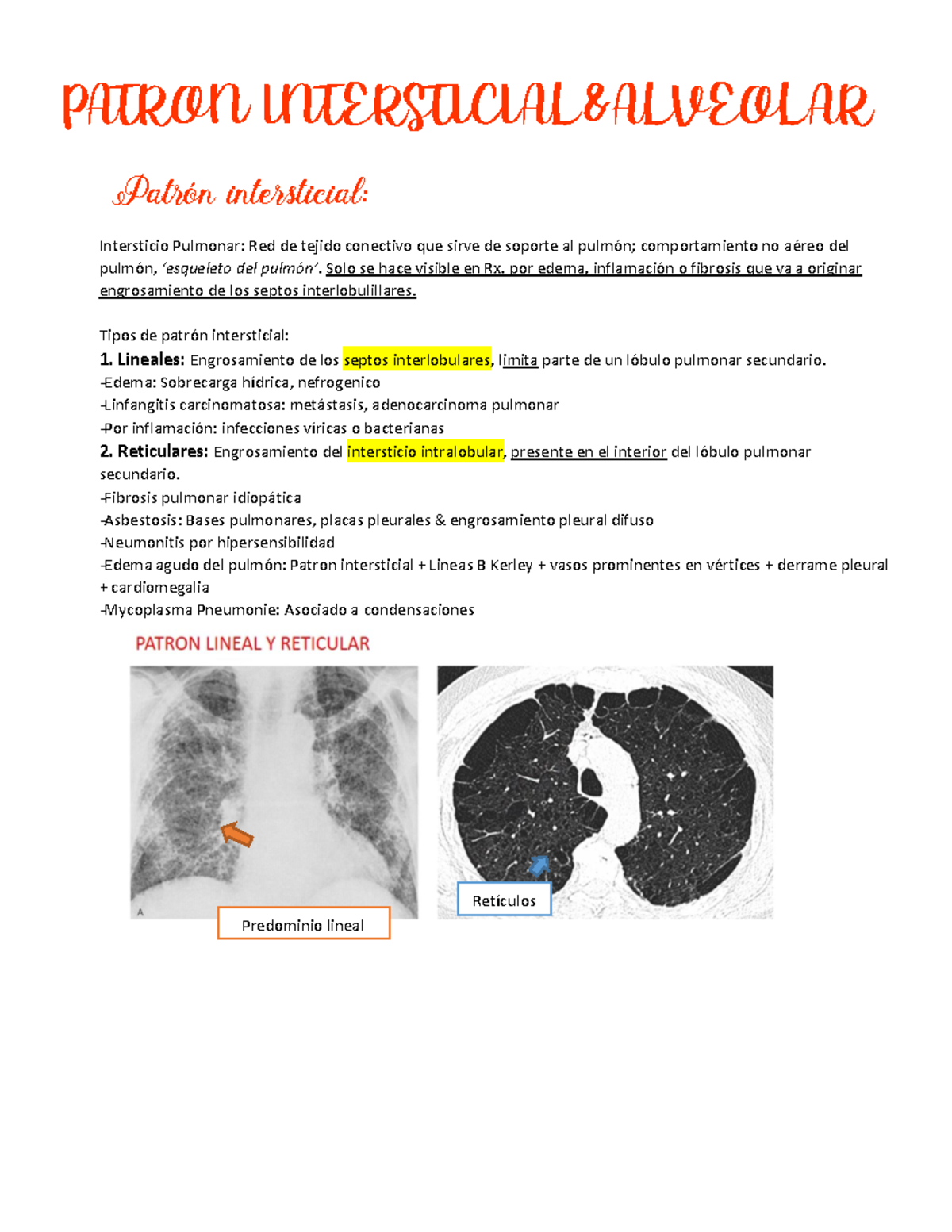 Patrón intersticial y patrón alveolar - Warning: TT: undefined function ...