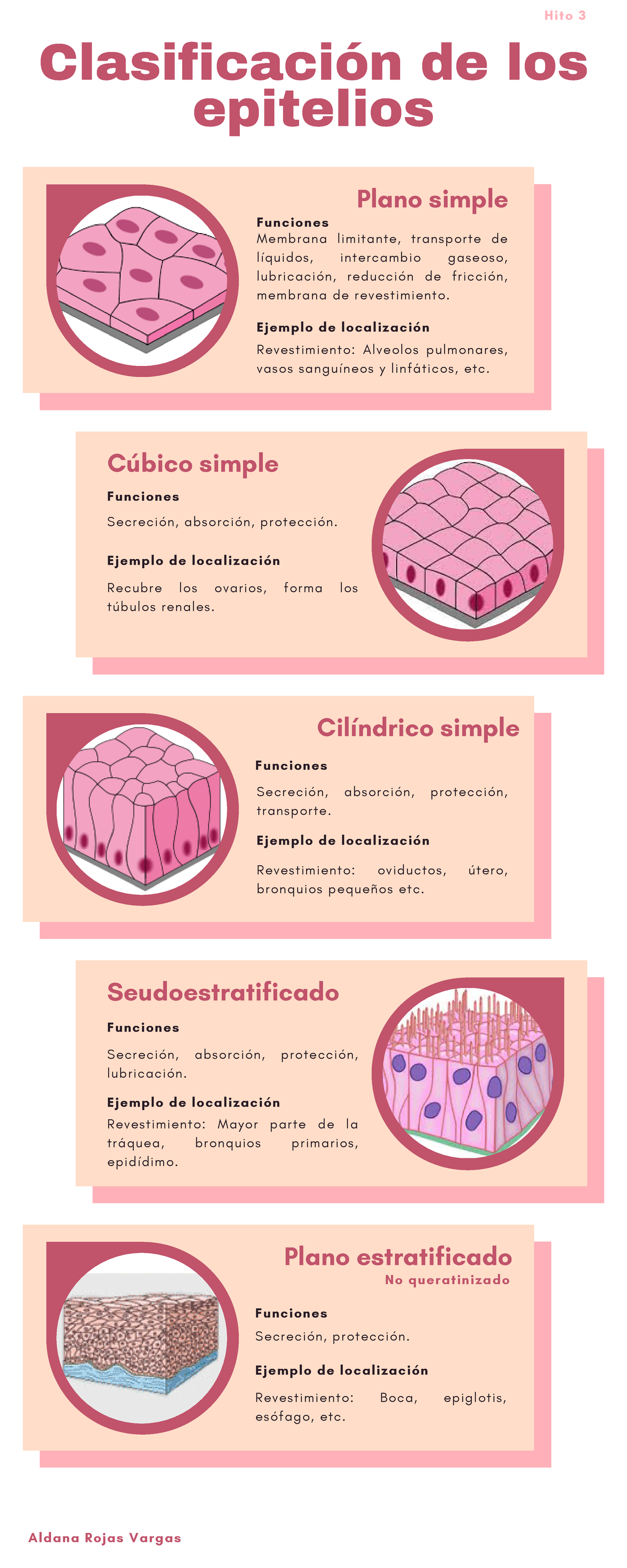 Infografía epitelios - Clasificación de los epitelios Plano simple Ejemplo de localización - Studocu