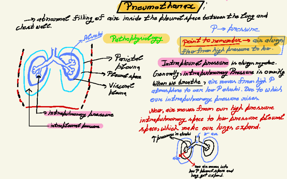 Pneumothorax - Pneumothora -abnormal filling of air inside the ...