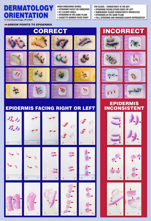 Poster Uscap 2016 Locking Tissue Orientation from Grossing Through ...