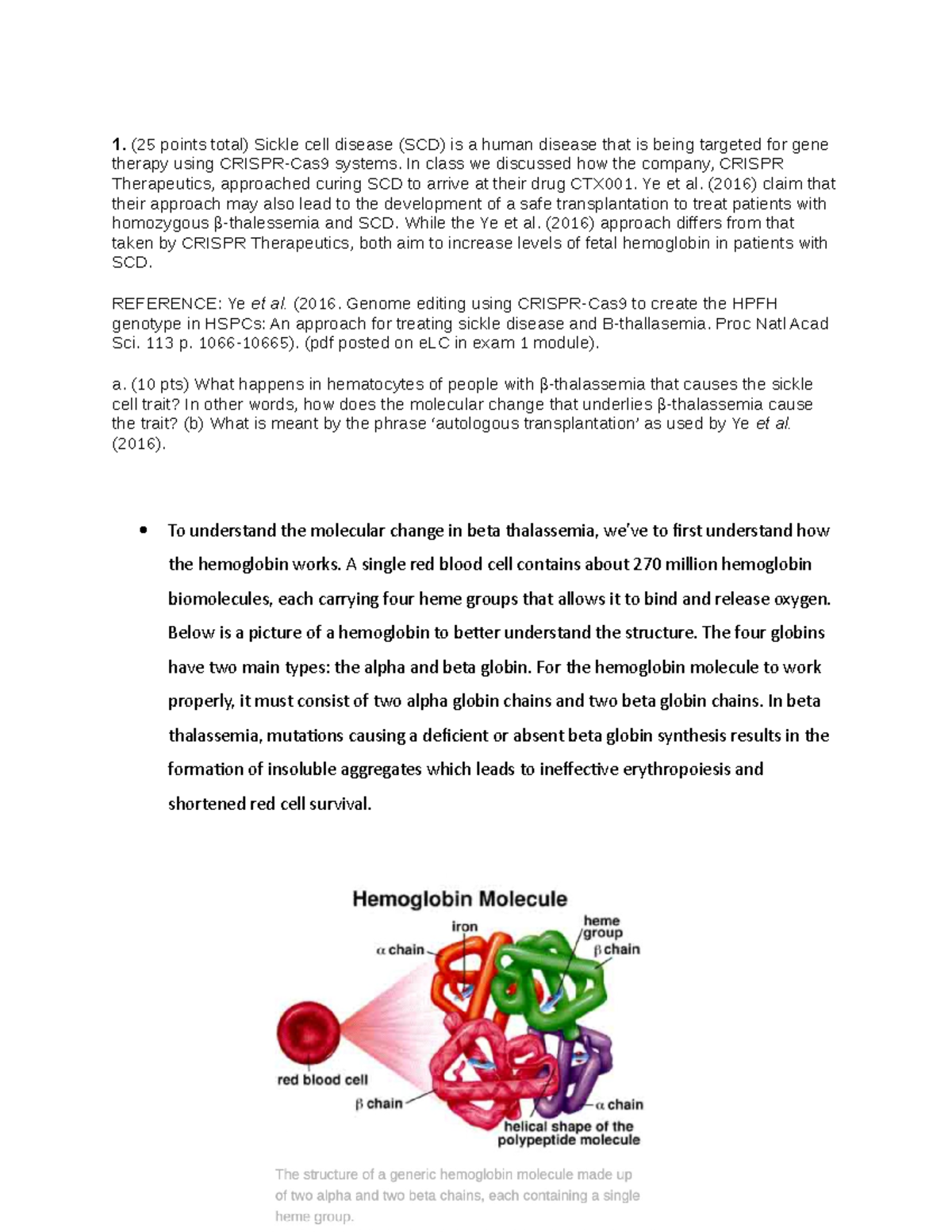 Biotech Exam - Grade: A - 1. (25 points total) Sickle cell disease (SCD ...