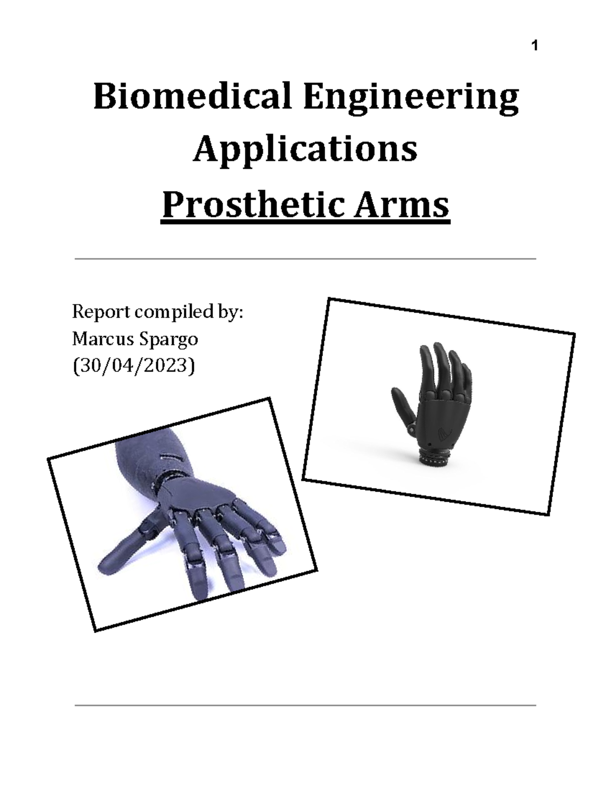 Prosthetic Arms - Engineering Report Marcus Spargo - Biomedical ...