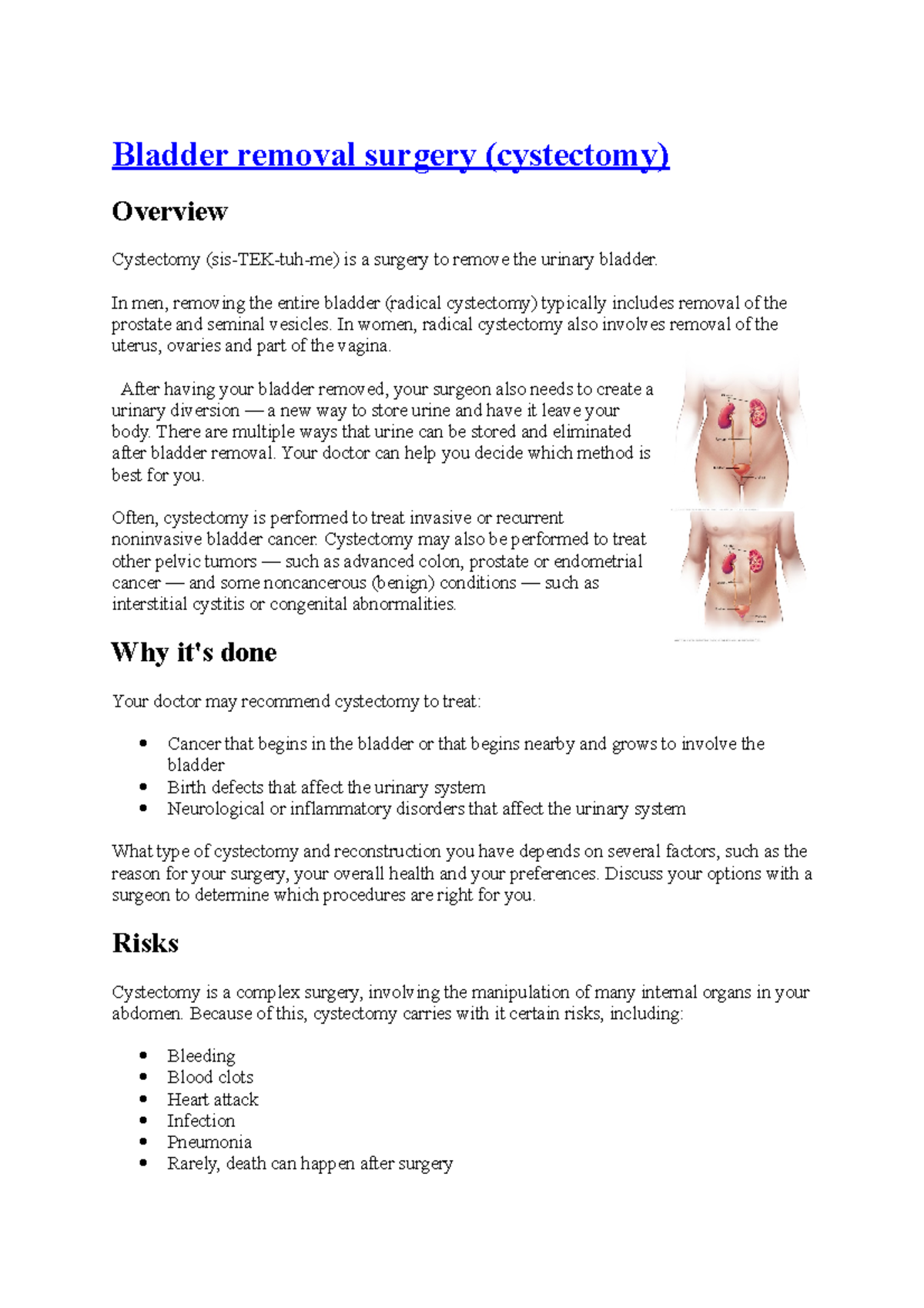 Bladder removal surgery (cystectomy) - Bladder removal surgery ...