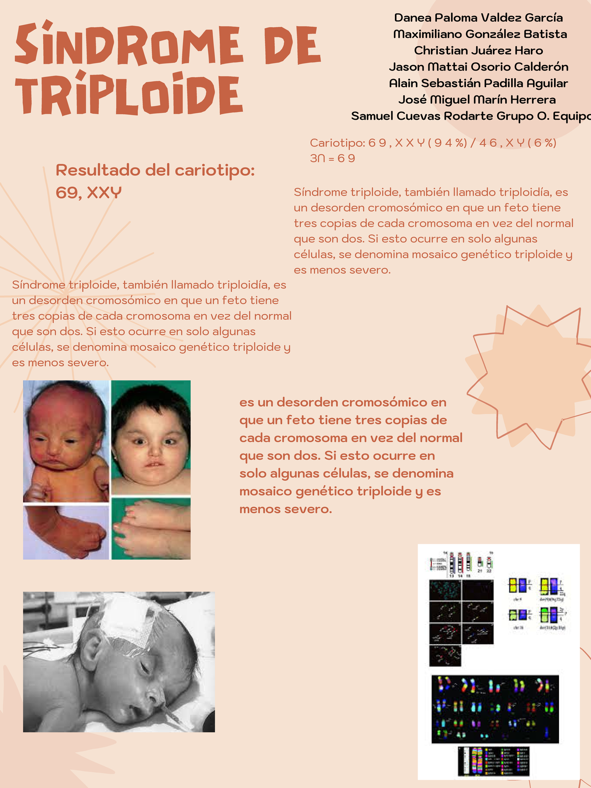 Síndrome de Tríploide - Grupal embrio - SÍNDROME DE TRÍPLOIDE Cariotipo ...