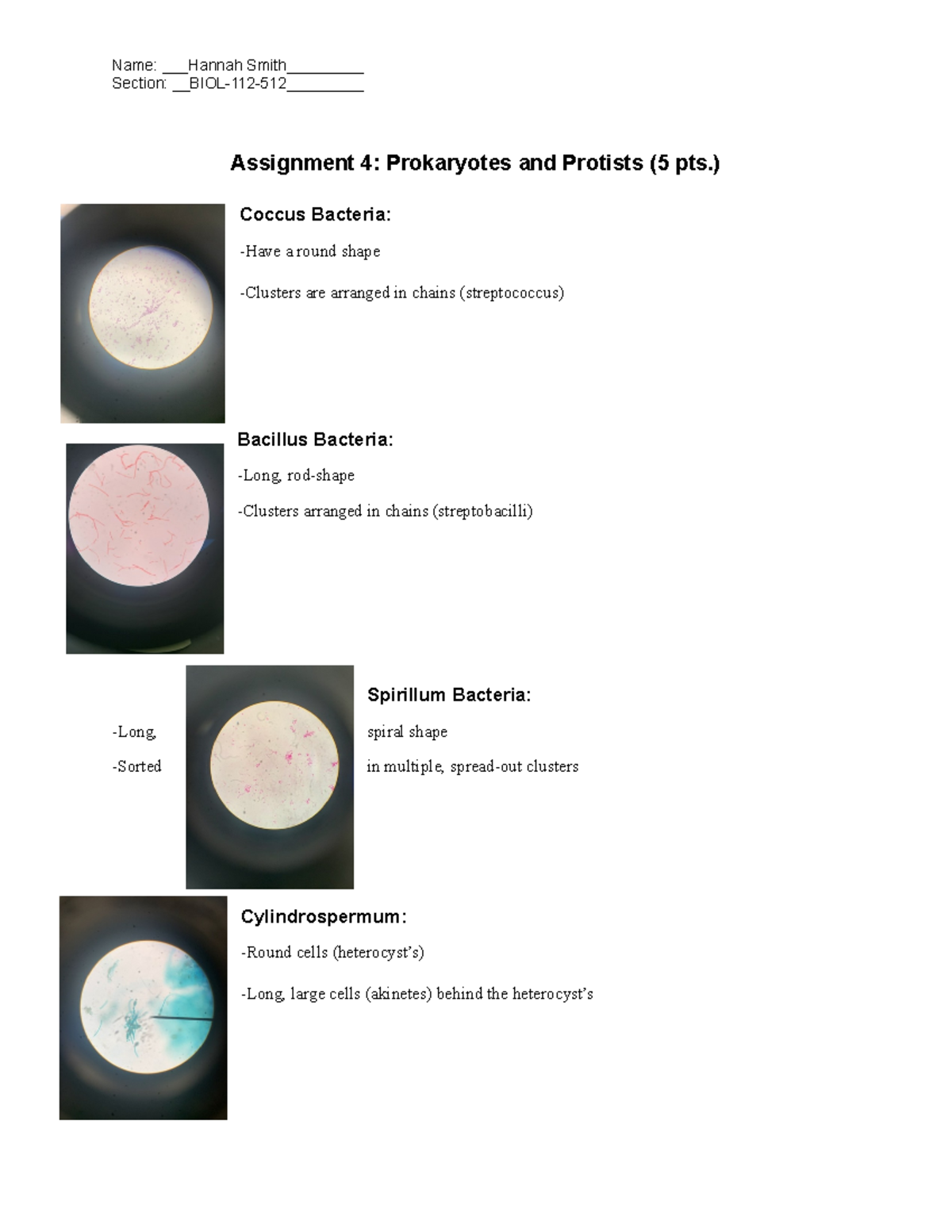 Prokaryotes Lab Assignment - Section: BIOL-112-512_______ Assignment 4 ...
