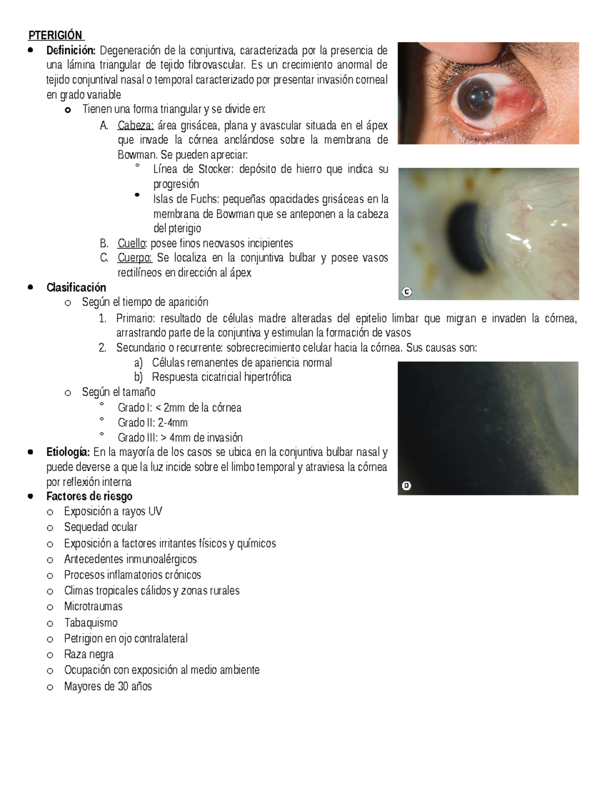Pterigión - Es un crecimiento anormal de tejido conjuntival nasal o ...