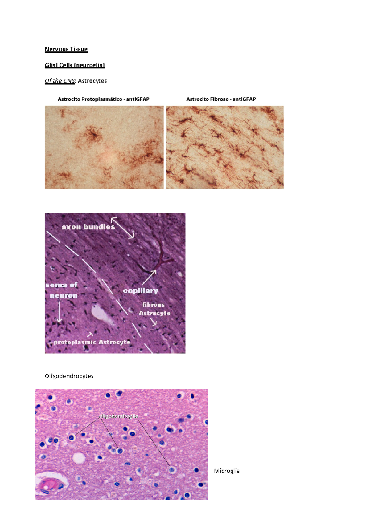 Nervous Tissue - medical - Nervous Tissue Glial Cells (neuroglia) Of ...