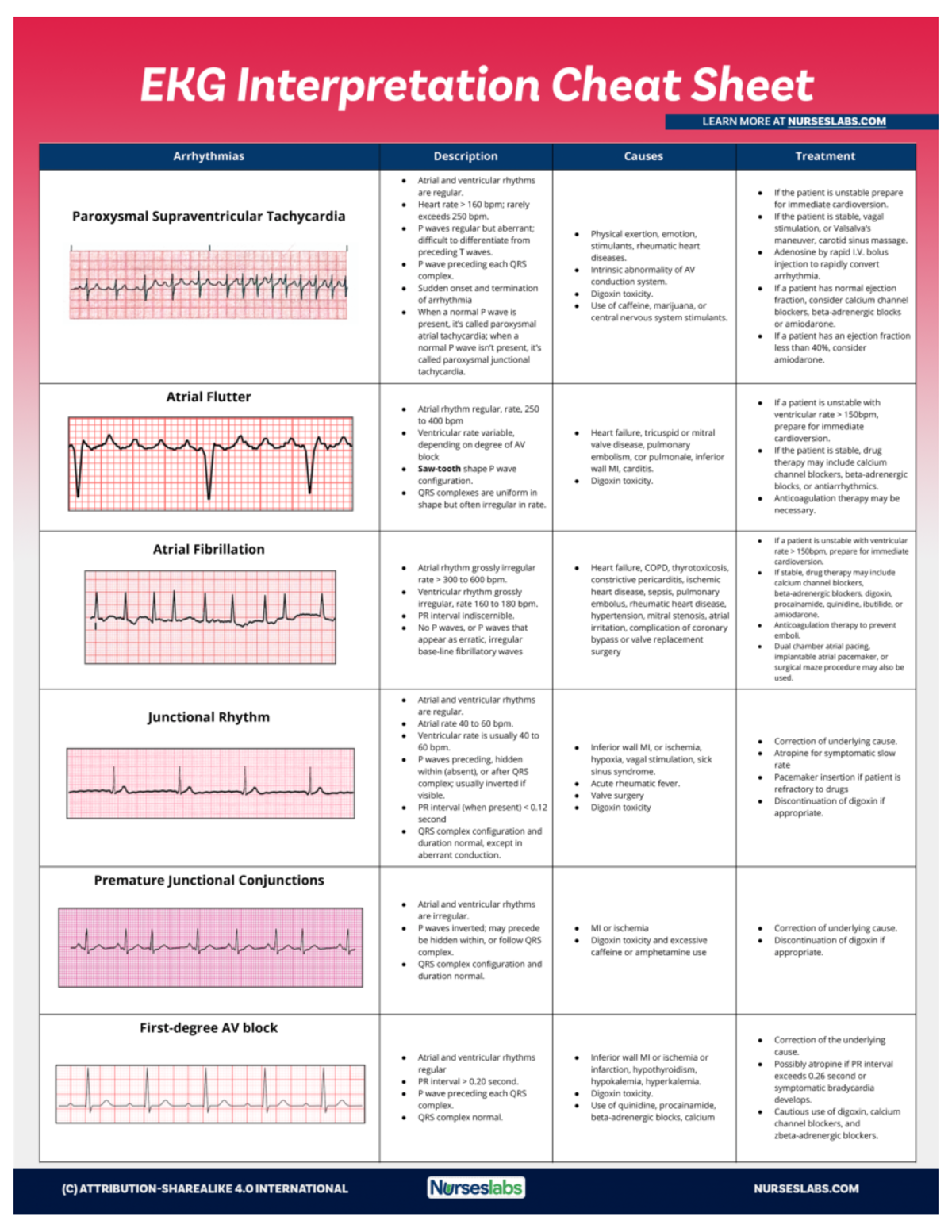 EKG-Interpretation-Cheat-Sheet-for-Heart-Arrhythmias Nurseslabs 2 ...