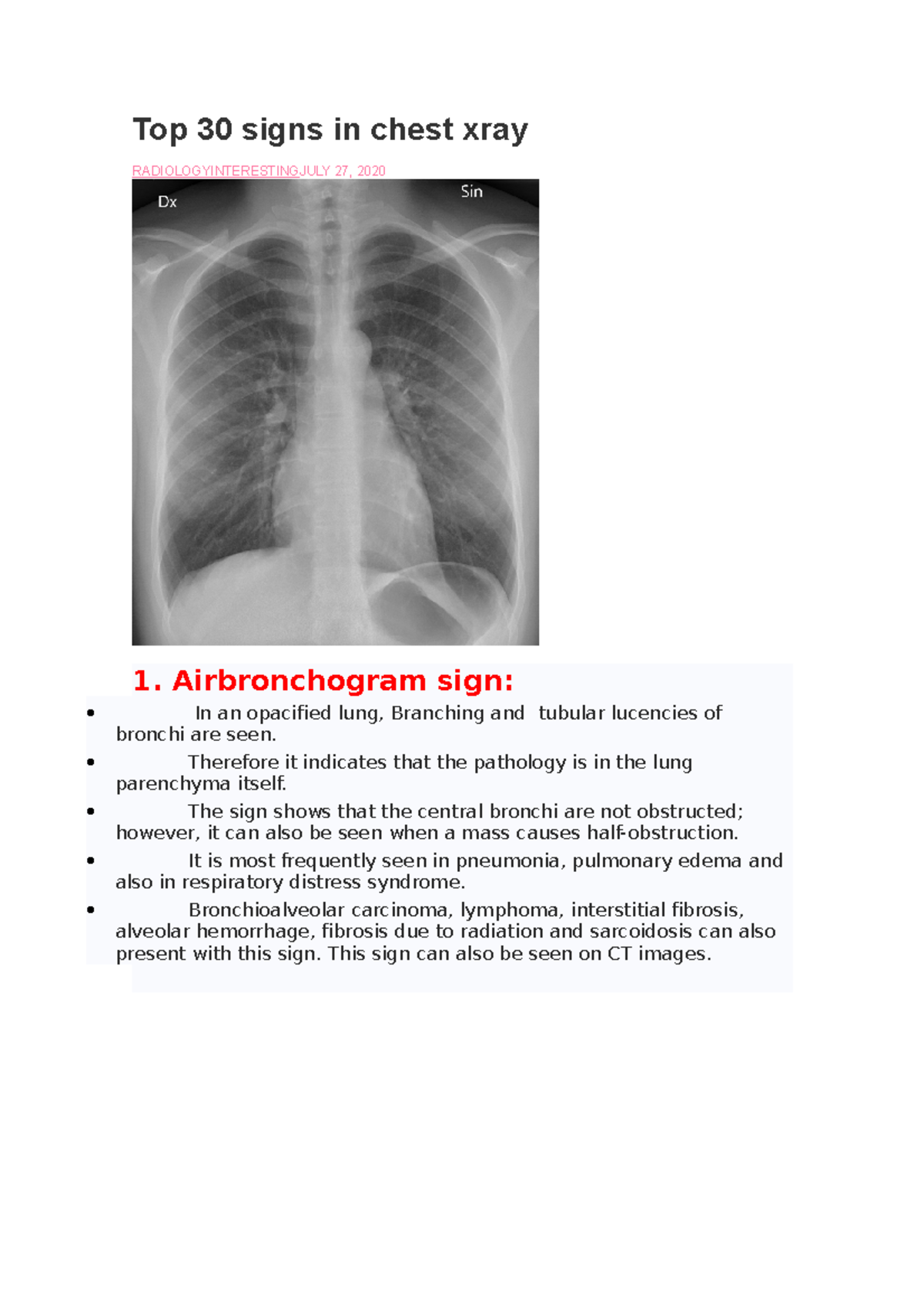 Top 30 signs in chest xray - Top 30 signs in chest xray ...