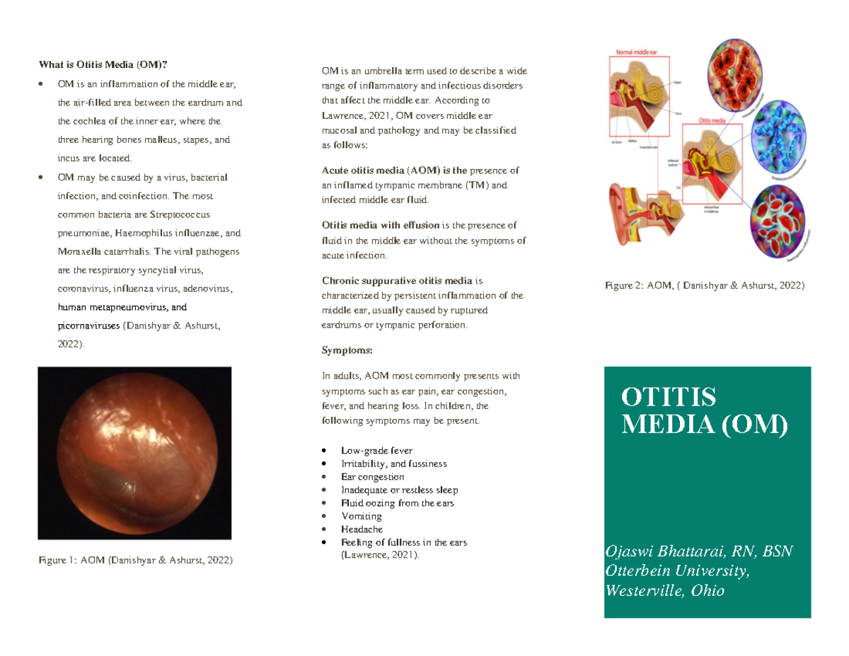 Professional Ed Handout - What is Otitis Media (OM)? OM is an ...