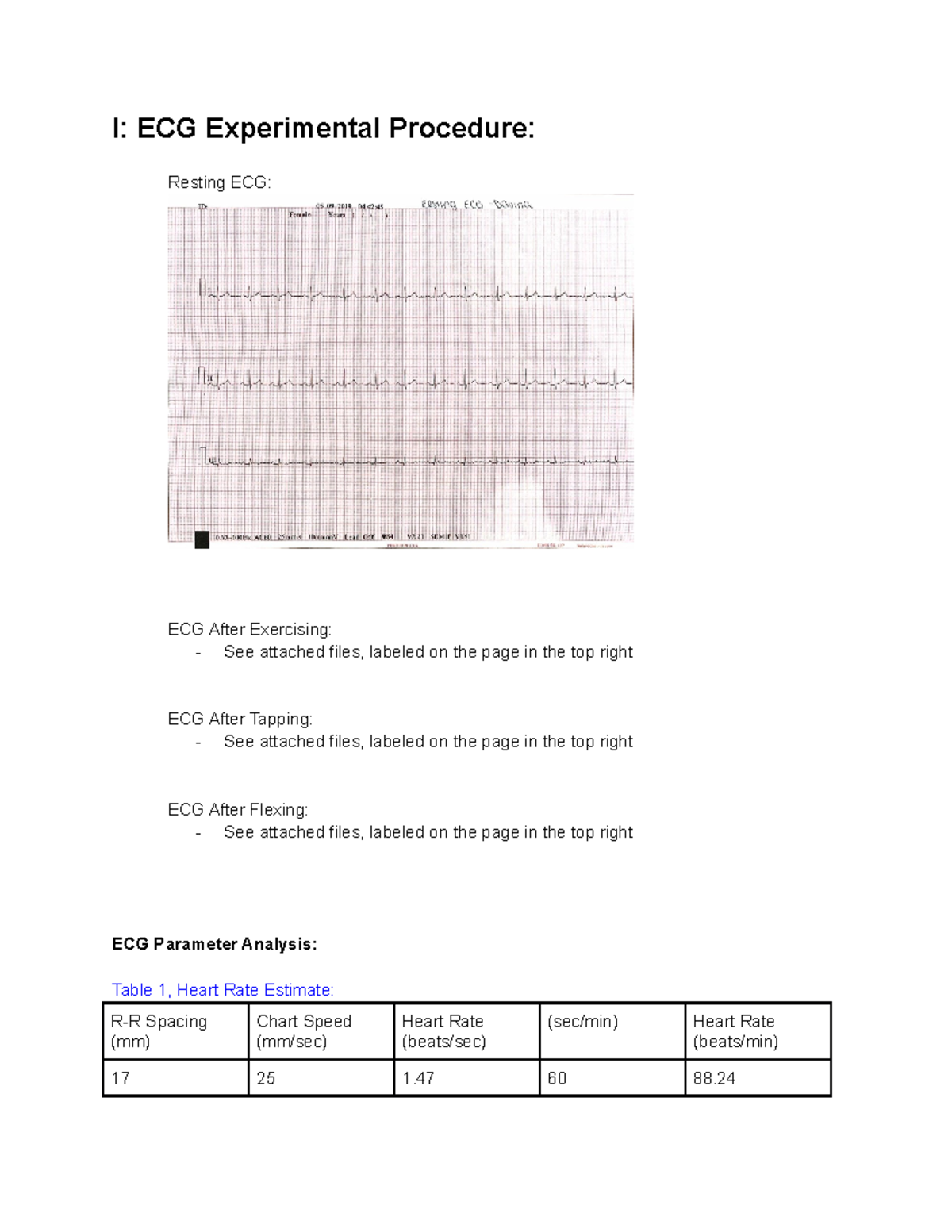 BIEN Lab 2 - Lab Report. - I: ECG Experimental Procedure: Resting ECG ...