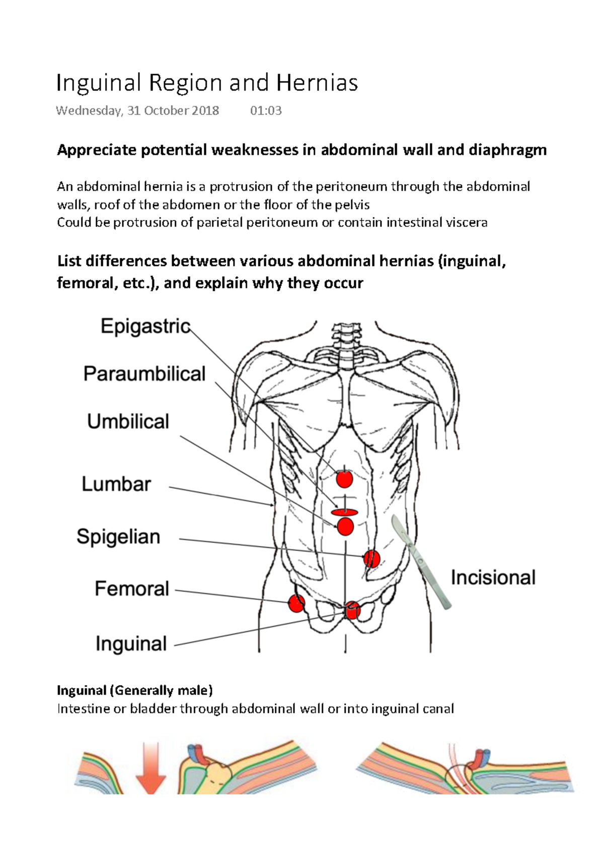 Inguinal Region and Hernias - Appreciate potential weaknesses in ...