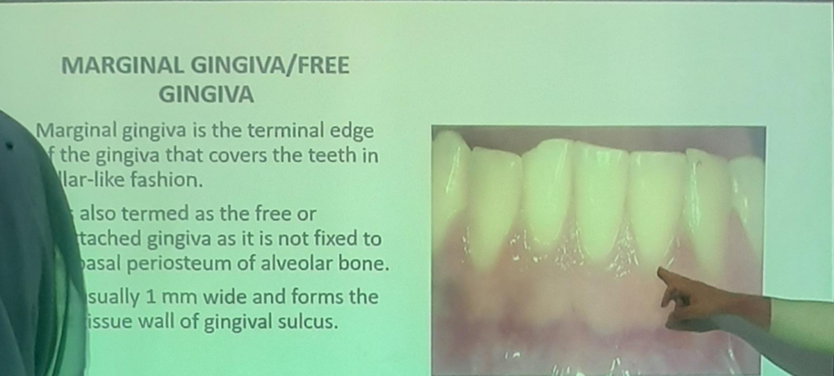 Healthy Gingiva - MARGINAL GINGIVA/FREE GINGIVA Marginal gingiva is the ...