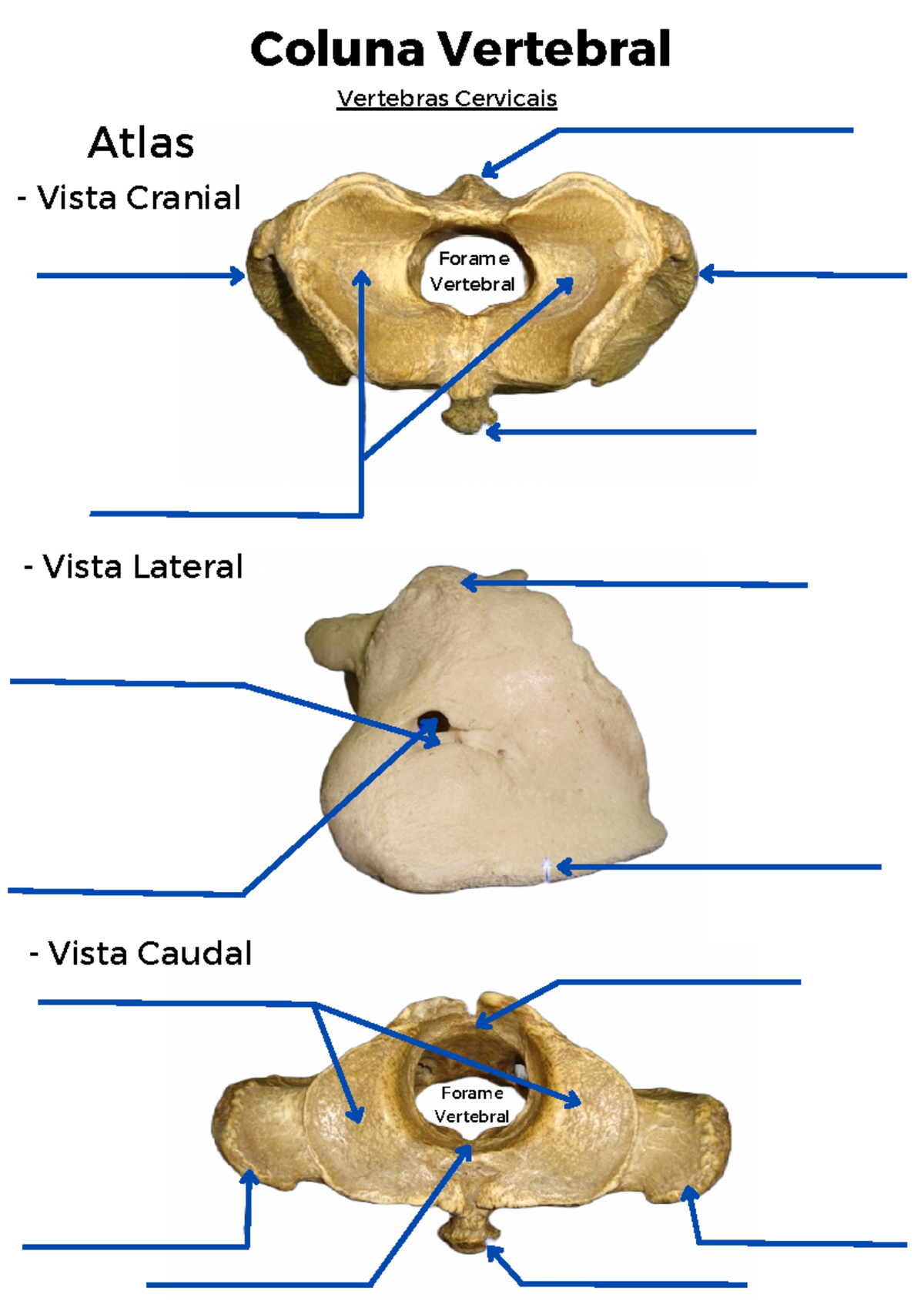 Coluna Vertebral - Coluna Vertebral Atlas - Vista Cranial - Vista ...