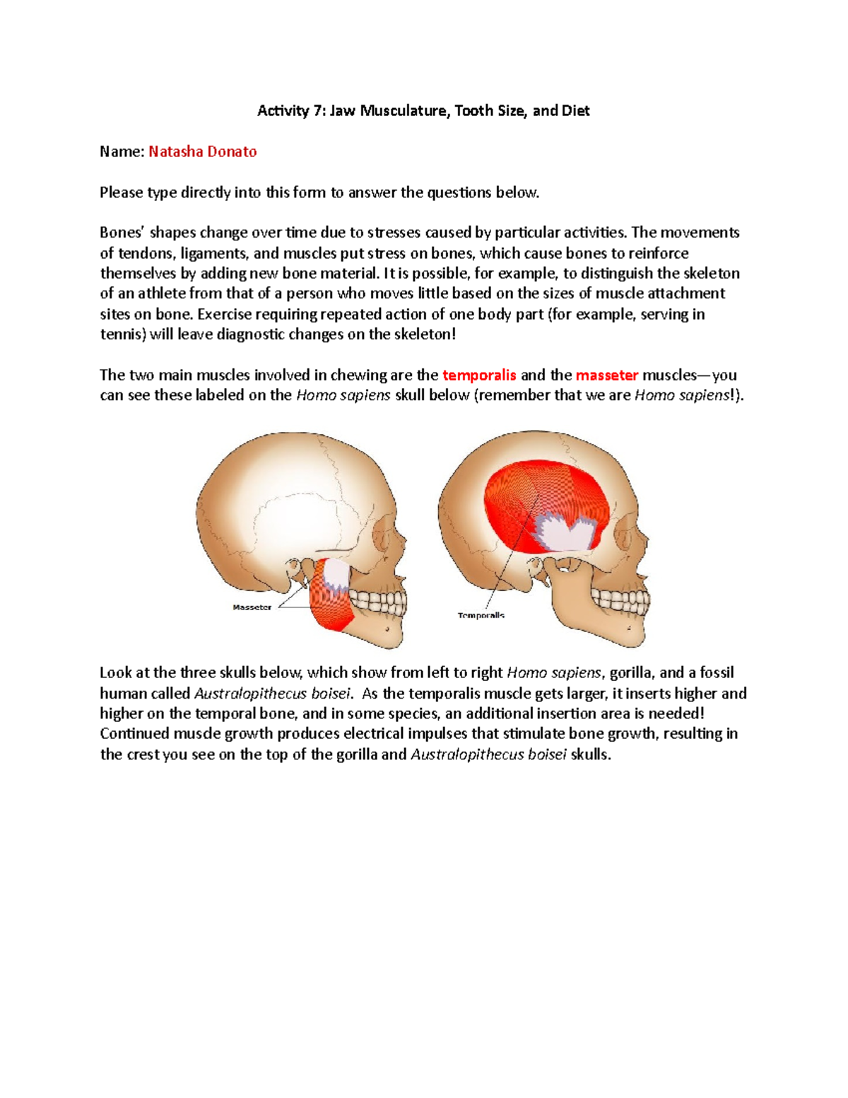 Activity 7 Chewing Musculature Lab - Activity 7: Jaw Musculature, Tooth ...