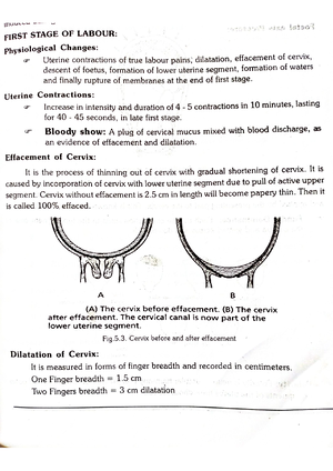 Delivery of placenta and membranes - Obstetrics and gynaecology of ...