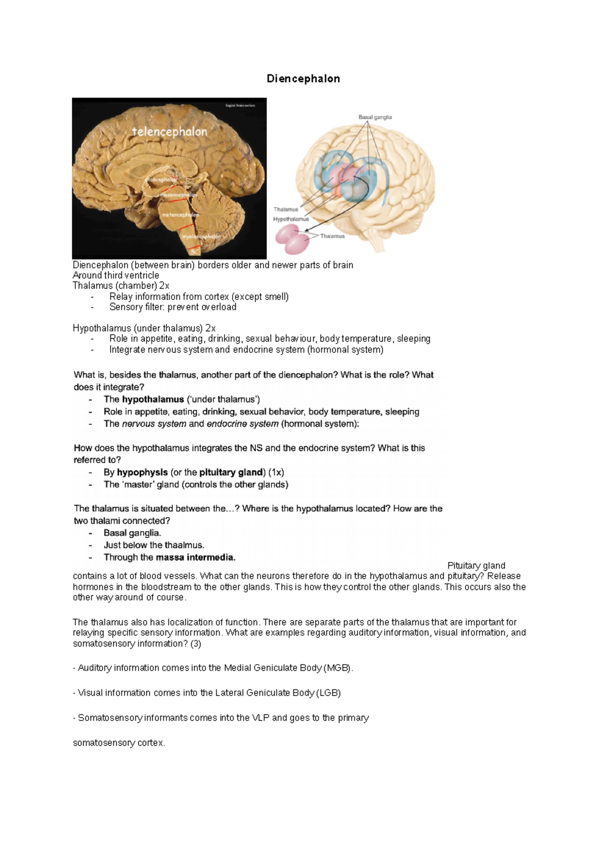 Diencephalon - Anatomy - Diencephalon Diencephalon (between brain ...
