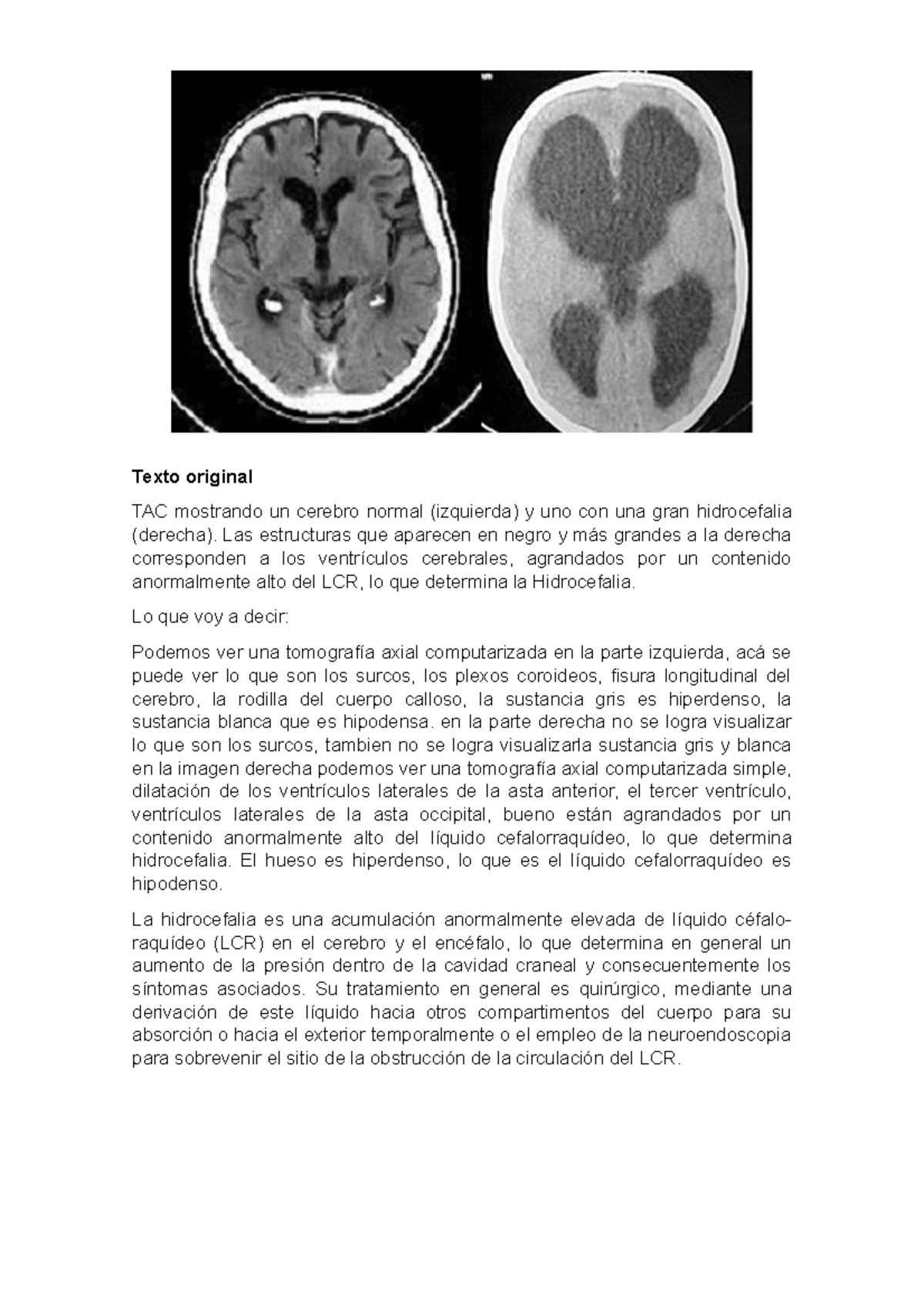 Tomografia cerebral - medicinamedicinamedicinamedicina - Texto original ...