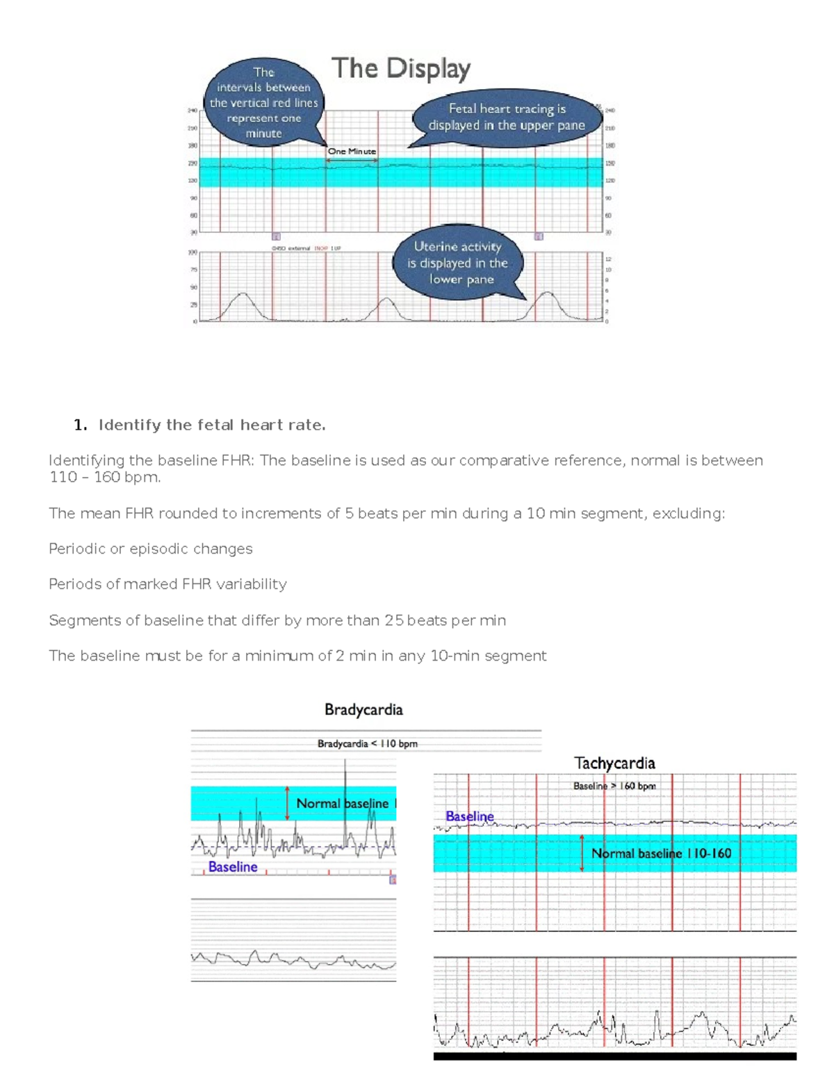 Fetal Heart Rate Monitoring - Identify the fetal heart rate ...