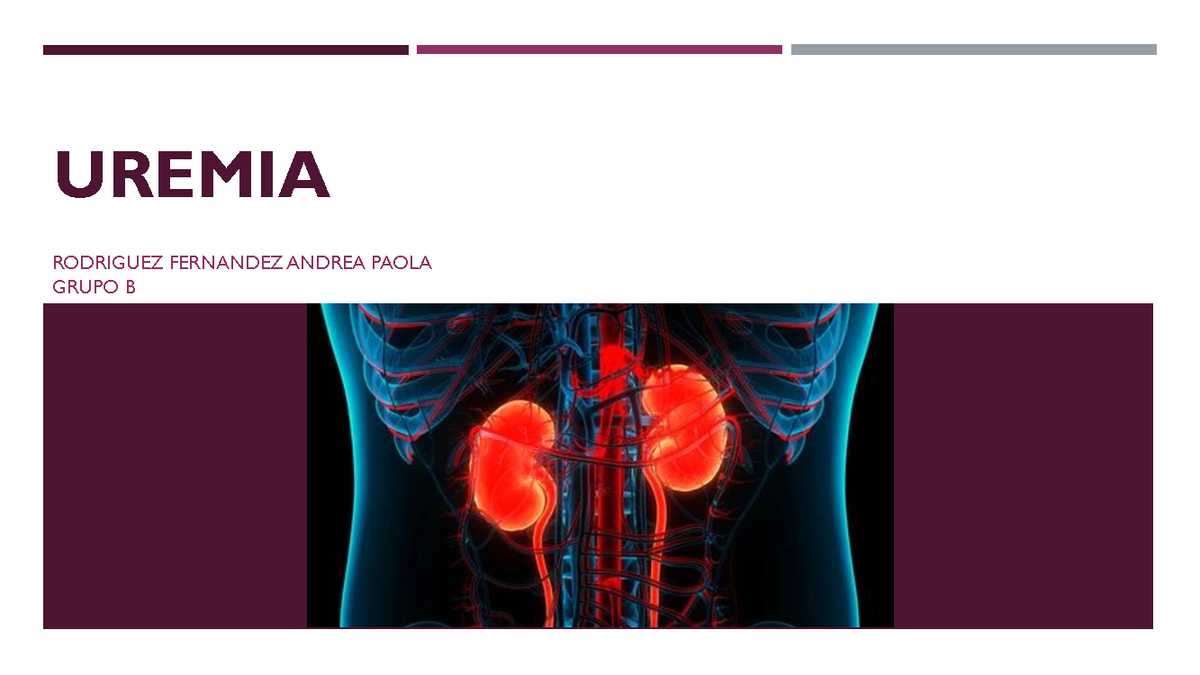 Uremia - UREMIA RODRIGUEZ FERNANDEZ ANDREA PAOLA GRUPO B QUE ES UREMIA ...