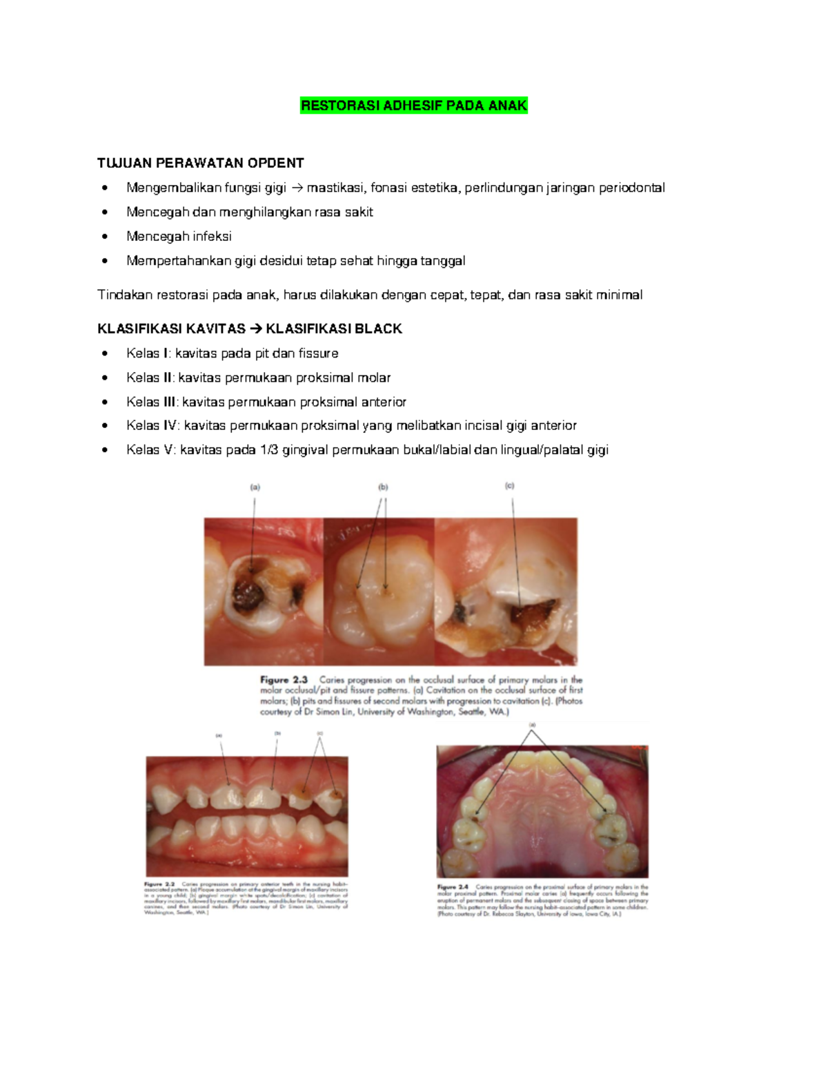 Restorasi Adhesive Pada Anak - RESTORASI ADHESIF PADA ANAK TUJUAN ...