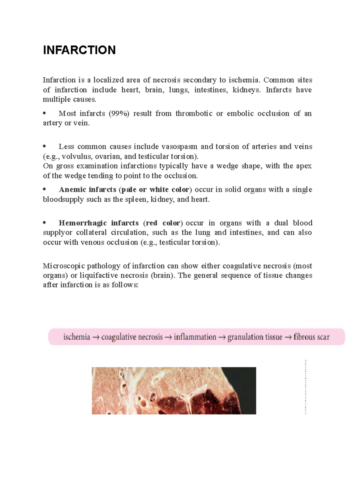 Infarction - notes - INFARCTION Infarction is a localized area of ...