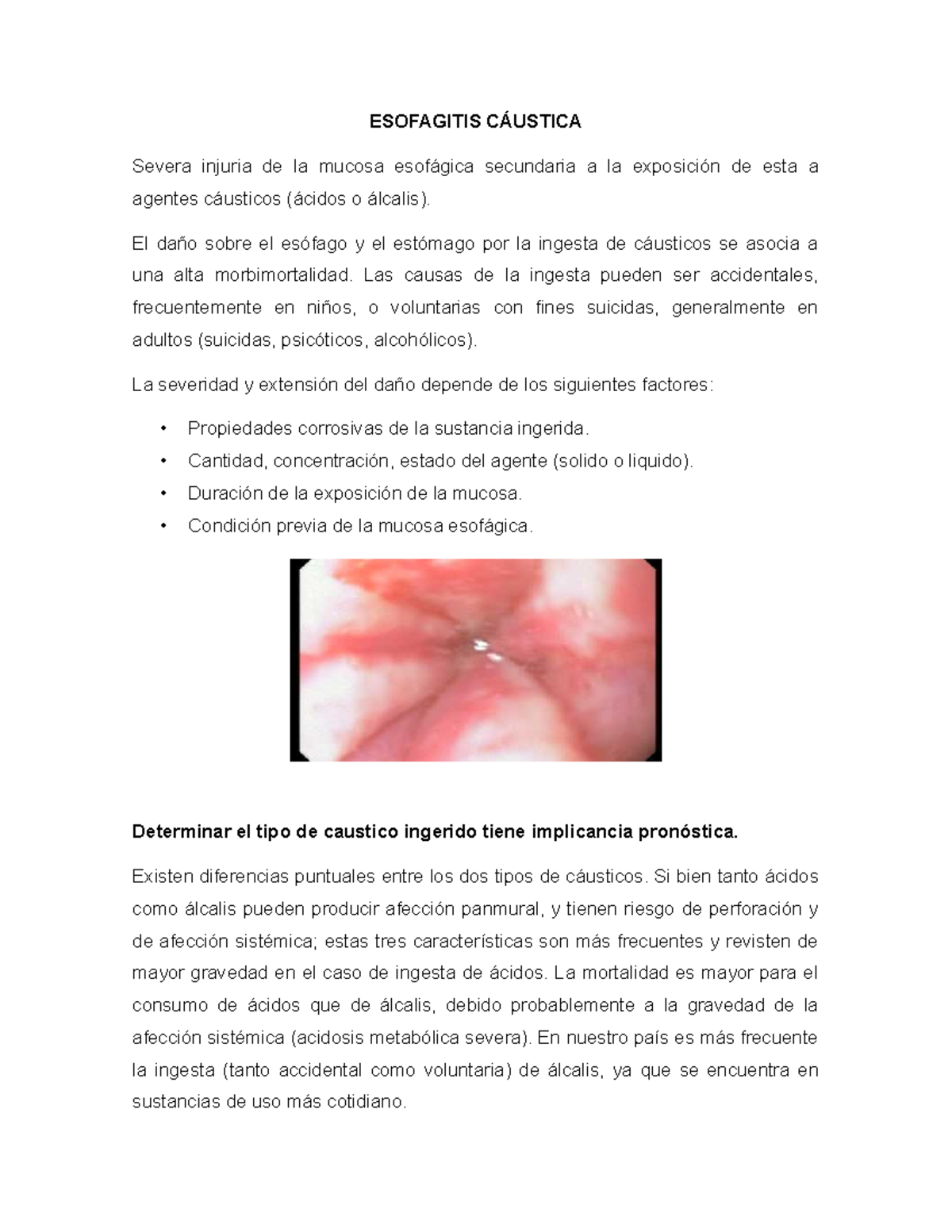 Esofagitis Cáustica - Resumen Gastroenterologia - ESOFAGITIS CÁUSTICA ...