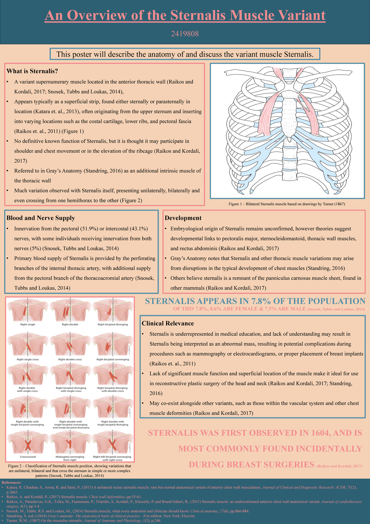 Sternalis Poster - An Overview of the Sternalis Muscle Variant ...