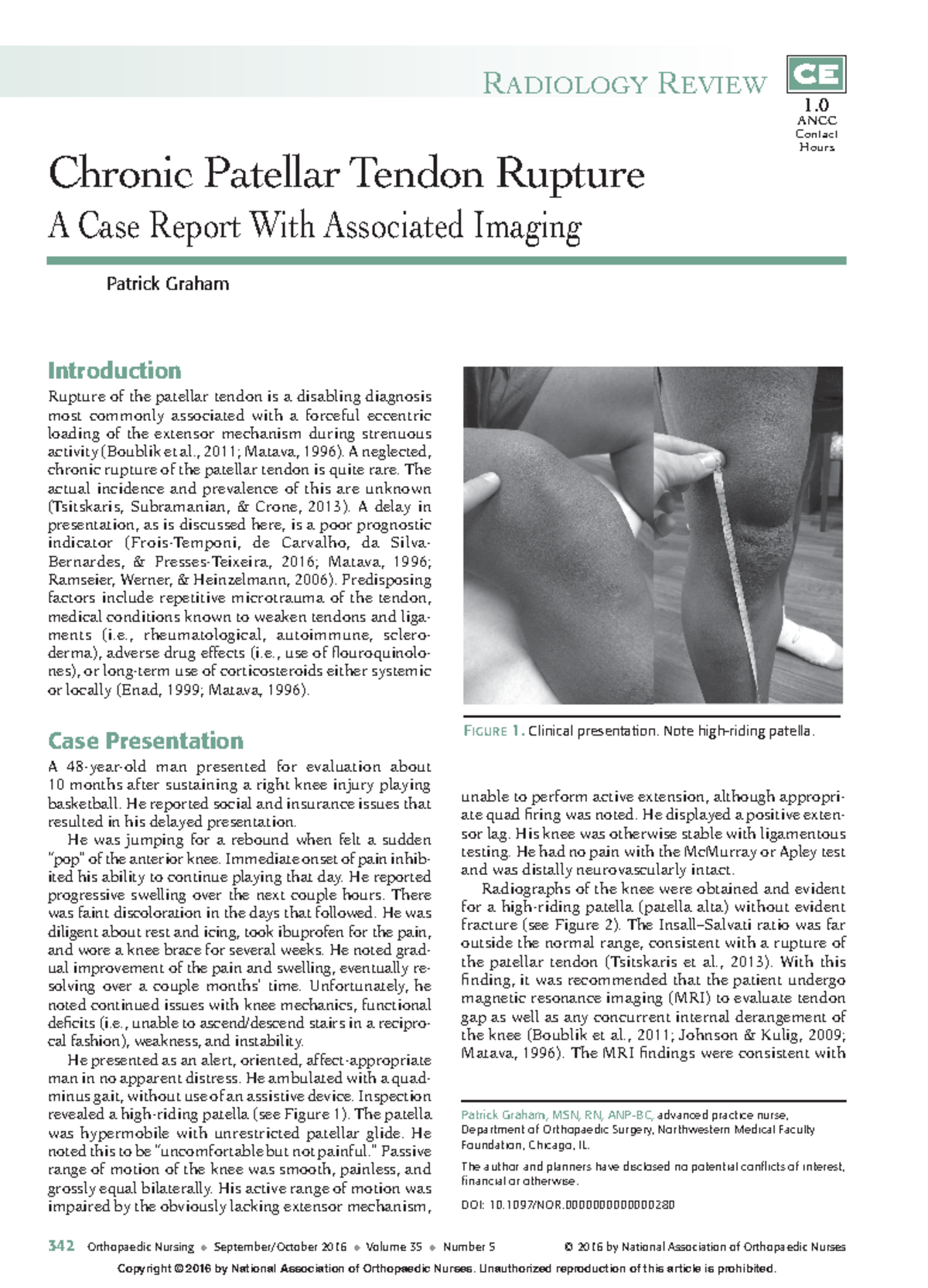Chronic Patellar Tendon Rupture A Case Report With Associated Imaging ...