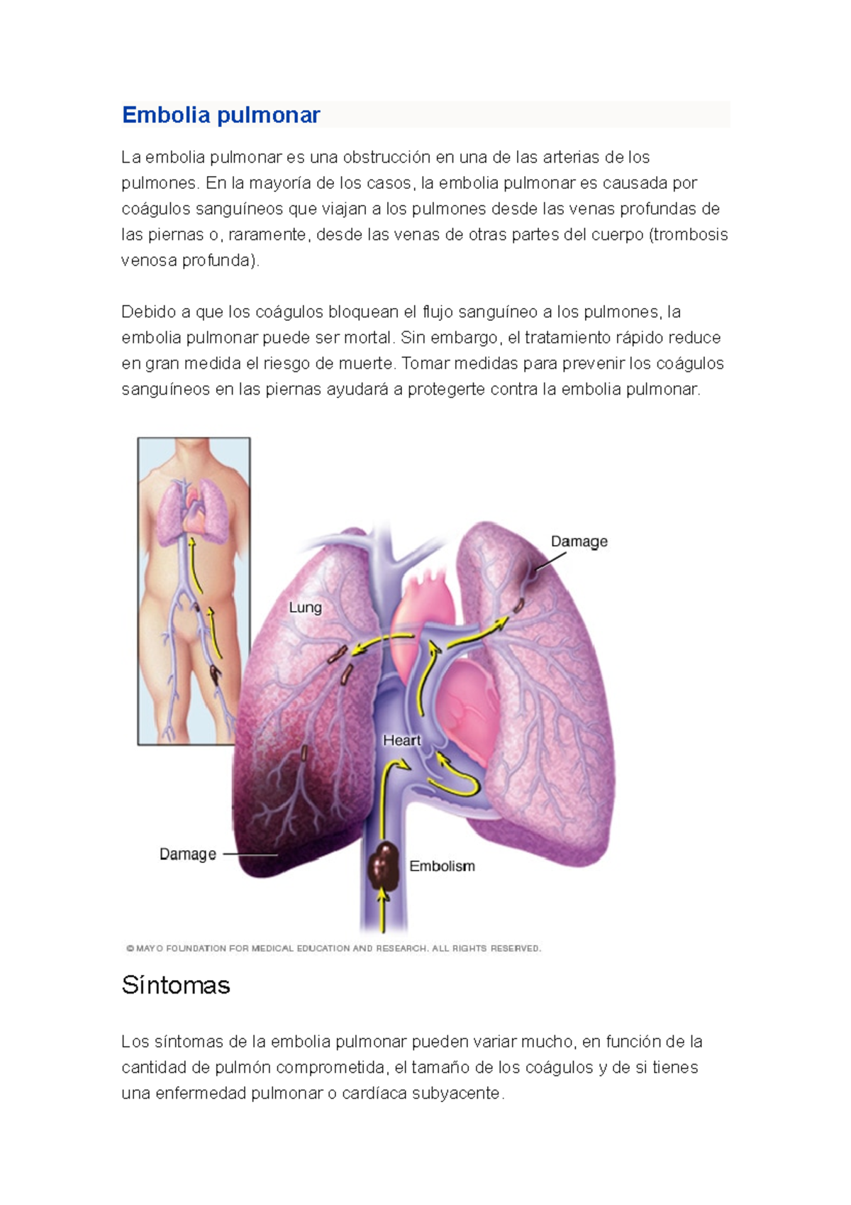 Embolia pulmonar ARA QUE LO APRENDAS MANO - Enfermería En Salud Del ...
