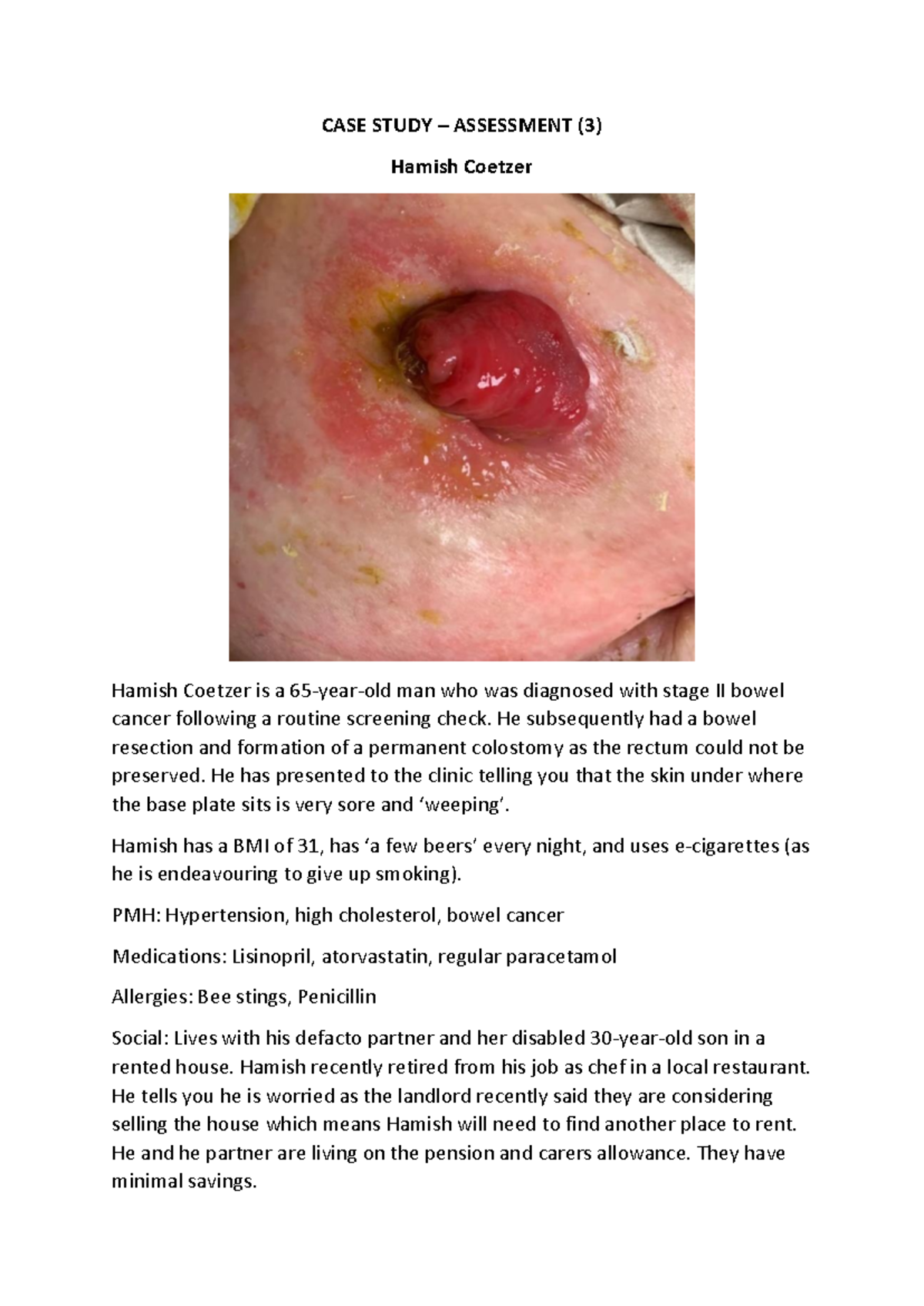 Hamish Coetzer (stoma) case study - CASE STUDY – ASSESSMENT (3) Hamish Coetzer Hamish Coetzer is ...
