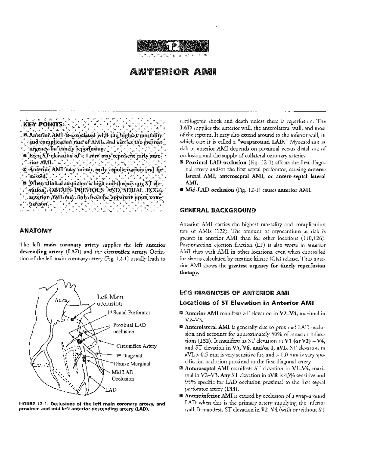 2 ECG in Acute MI - IAM - 12 ANTERIOR AMI KEY POINTS cardiogenic shock ...