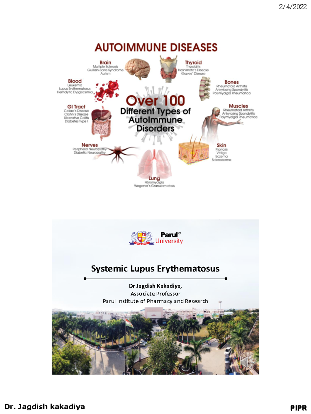 SLE - pharmacotherapeutics ii - Systemic Lupus Erythematosus Dr Jagdish ...