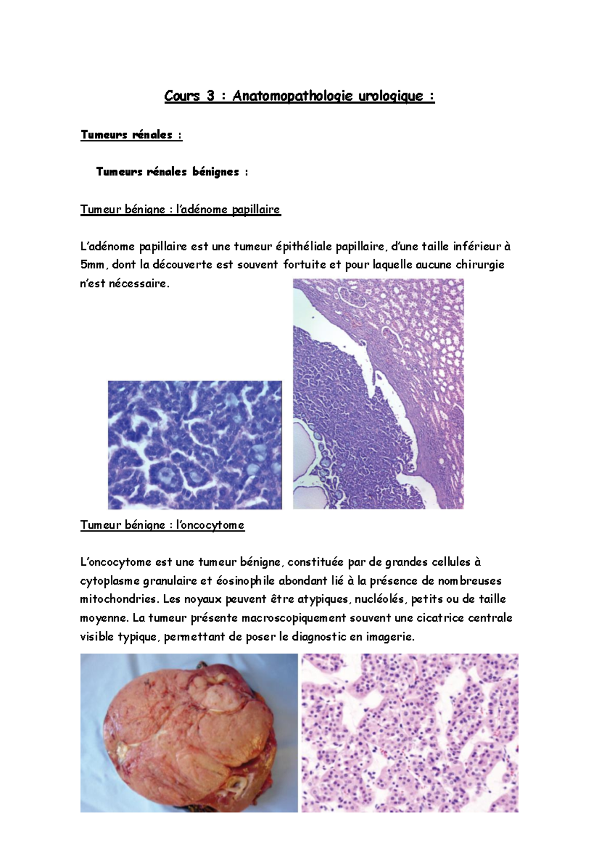 Cours 3 - Anatomopathologie urinaire - Anatomie Pathologique - UNamur ...