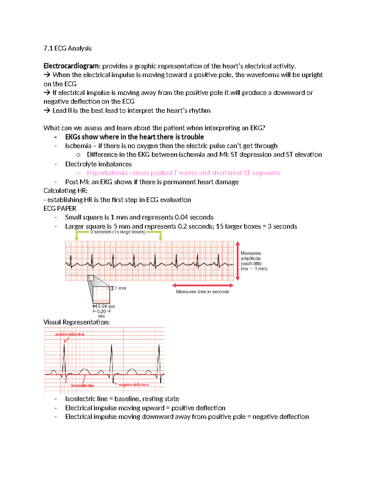 NUR 221 Test 1 Notes - 7 ECG Analysis Electrocardiogram: provides a ...
