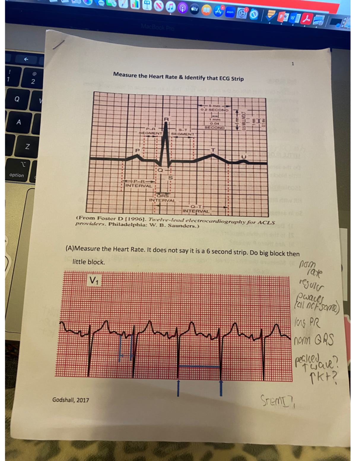 EKG packet 1 - 1 Measure the Heart Rate Identify that ECG Strip SECOND ...