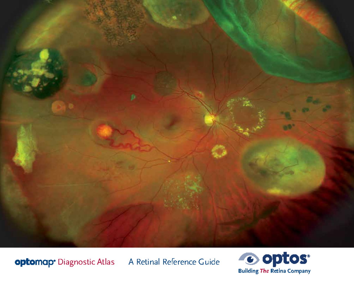 Diagnostic atlas book us - Building The Retina Company Diagnostic Atlas ...