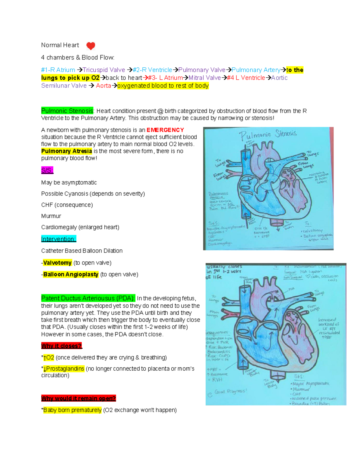 PEDS Heart - Normal Heart 4 chambers & Blood Flow: #1-R Atrium ...