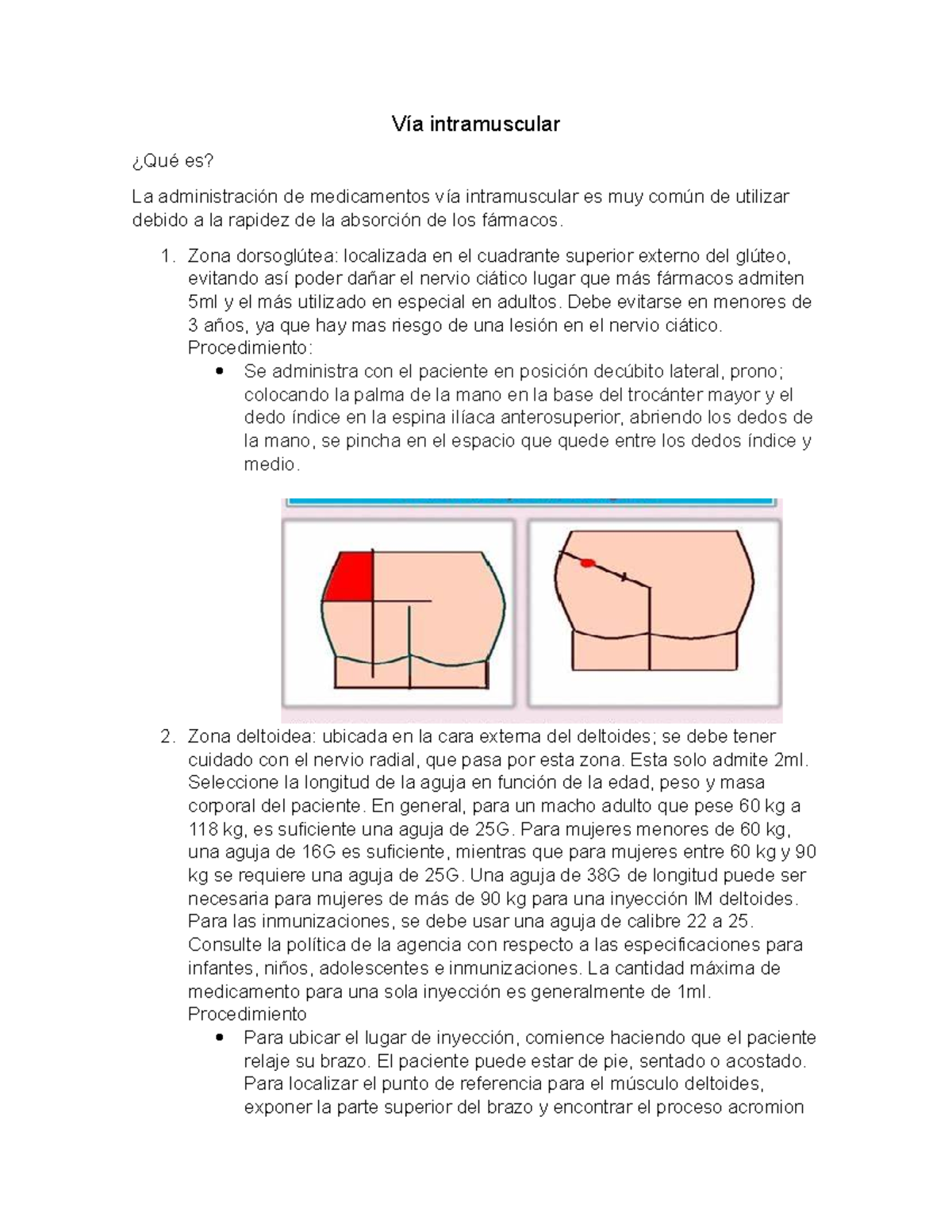 via muscular ensayo - Vía intramuscular ¿Qué es? La administración de ...