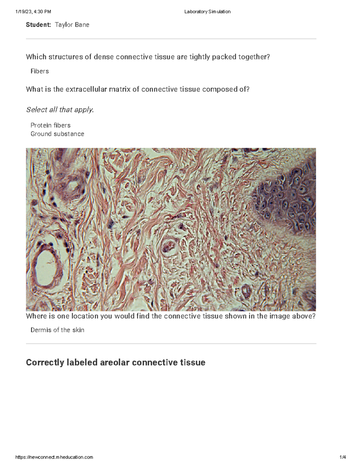 Microscopy - Connective Tissue Histology - BIO-210-104 - Student ...