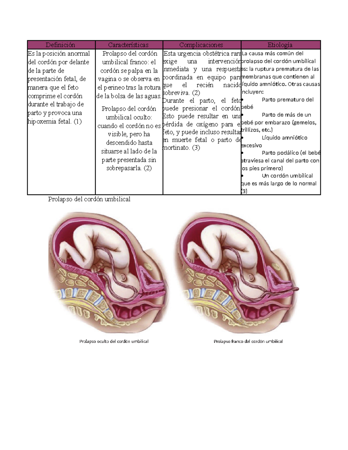 Prolapso del cordón umbilical Tabla - Definición Características ...