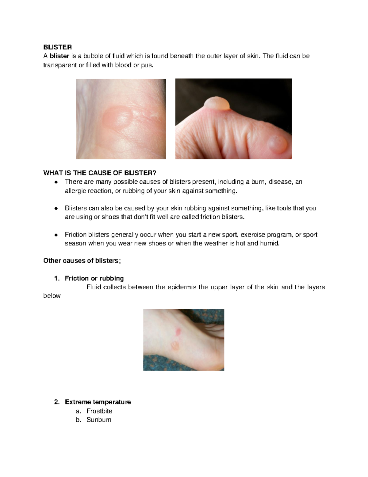 Blister - Study it. - BLISTER A blister is a bubble of fluid which is ...