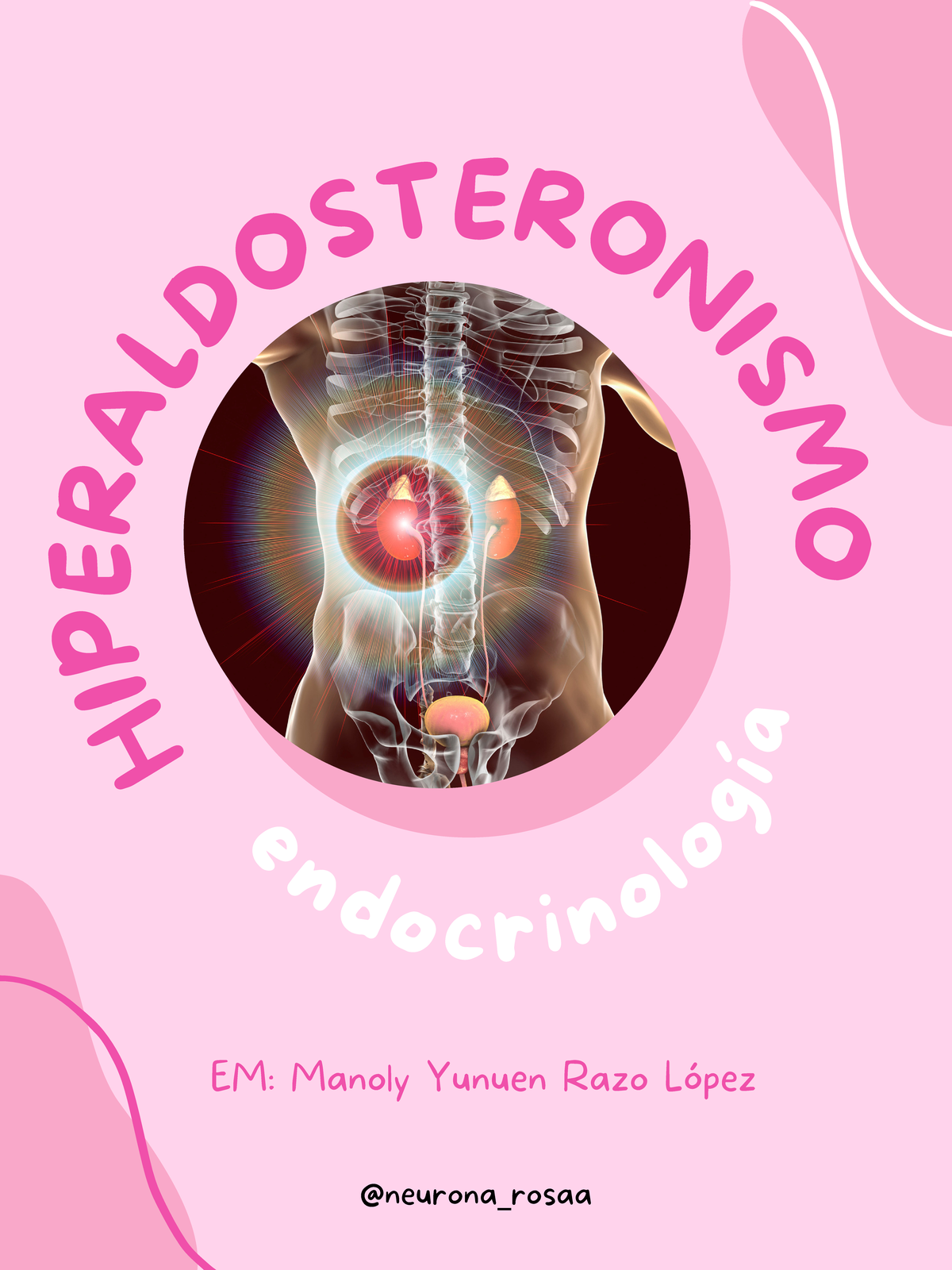 Hiperladosteronismo - Endocrinologia - H I P E R A L D O S TERO N I S M O e n d o c r i n o l o ...