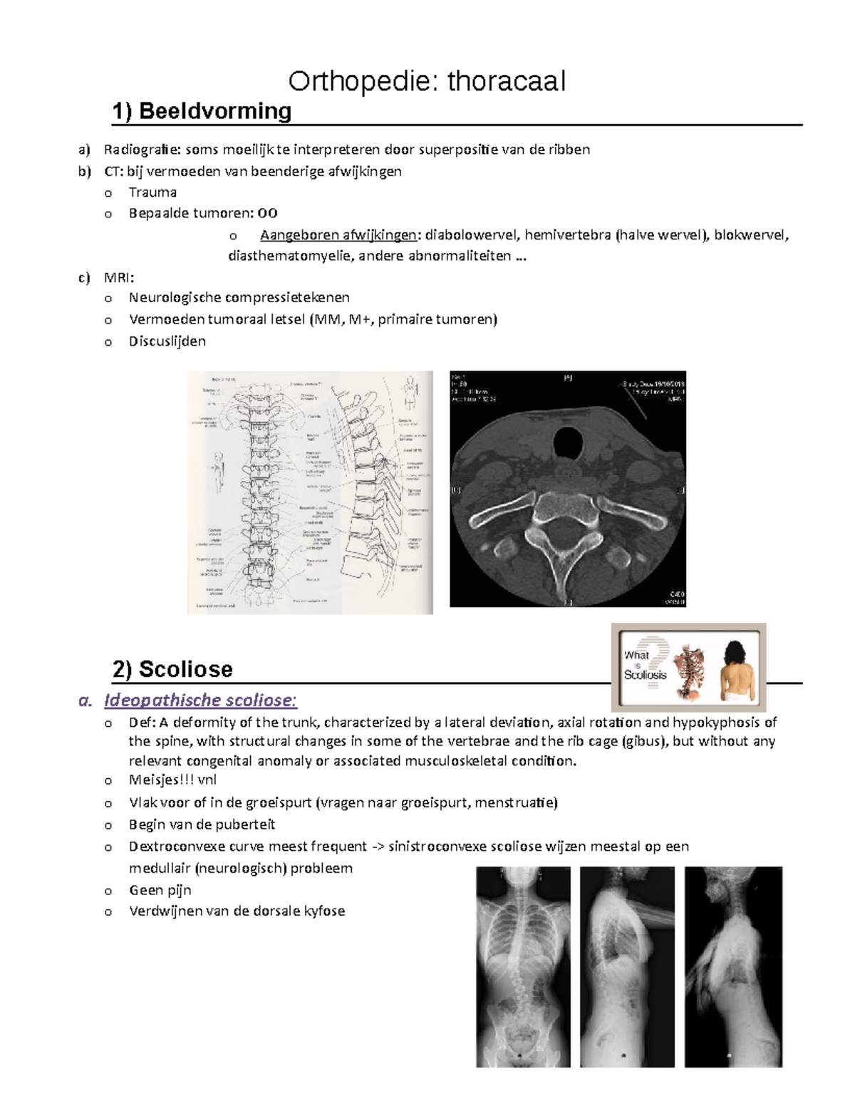 Orthopedie thoracaal - .. c) MRI: o Neurologische compressietekenen o ...