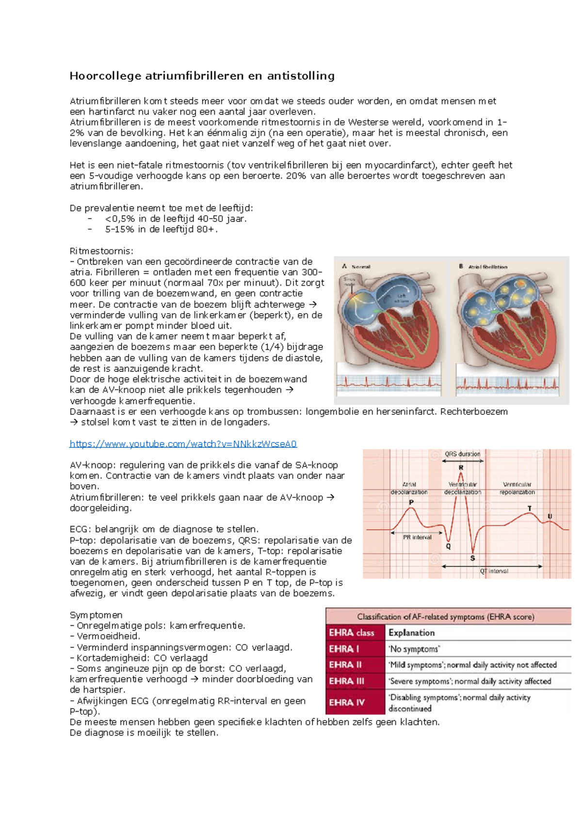 Hoorcollege atriumfibrilleren en antistolling - Hoorcollege atriumfibrilleren en antistolling ...