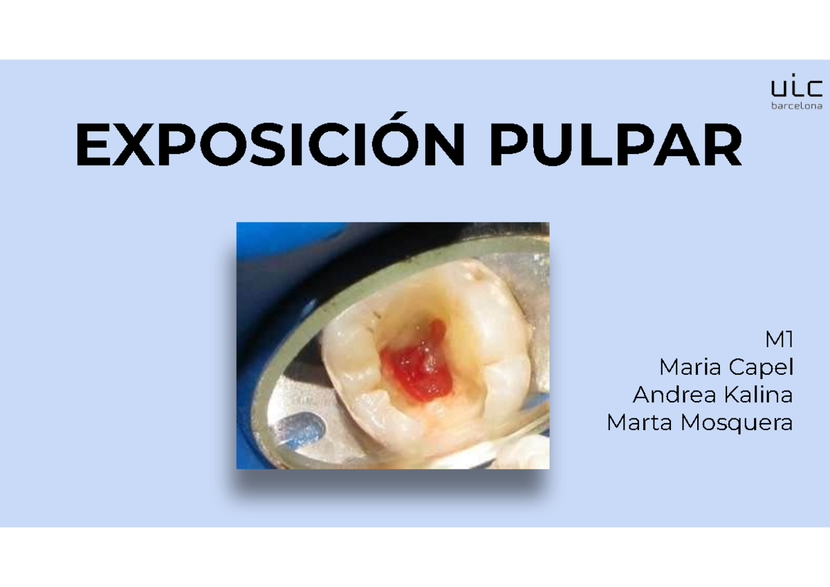 Exposición Pulpar - ,sksad -â¤ ̄U U v͸¤Äj¤ § t̂ tóƛŇó͸ óƘĞş ŪėƛĞó ...