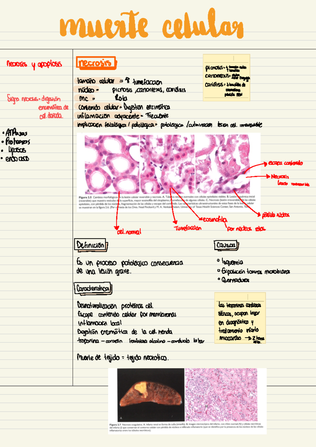 Patología - patologia 1er parcial - muerte celular necrosis 4 apoptosis ...