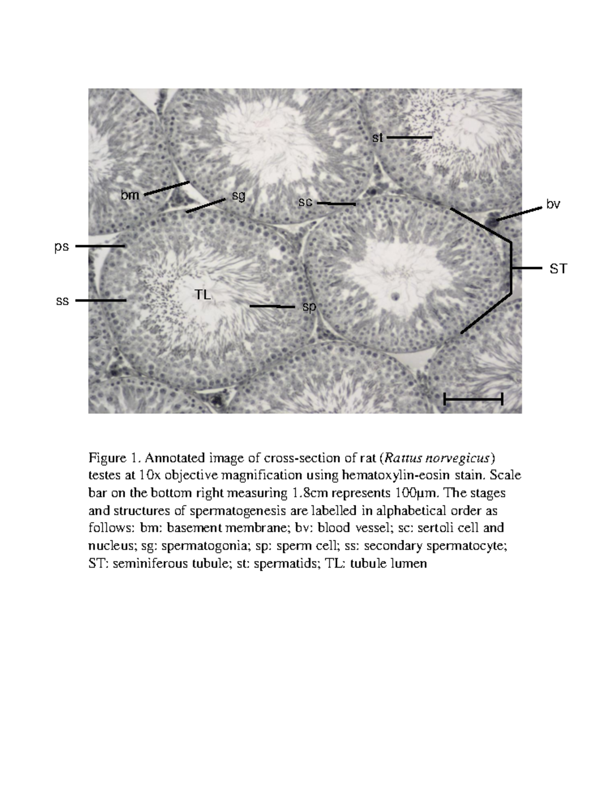 BIO1140 Meiosis Lab - Figure 1. Annotated image of cross-section of rat ...