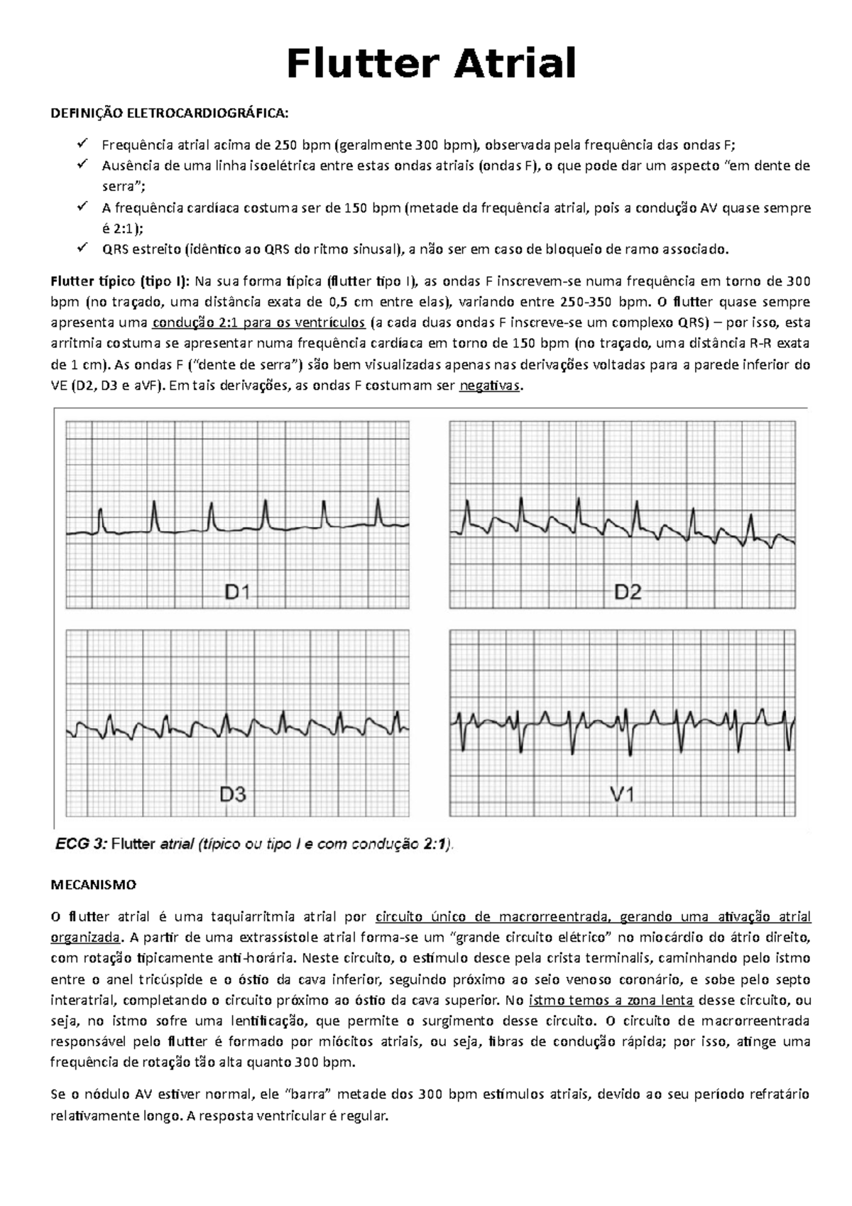 Flutter Atrial - Flutter Atrial DEFINIÇÃO ELETROCARDIOGRÁFICA ...