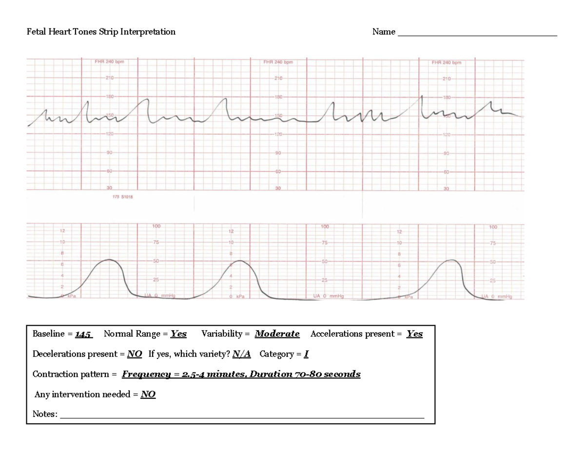 Answer KEY-Fetal Heart Tones Strip Interpretation - Fetal Heart Tones ...